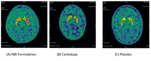 Scintigraphy – NBI Biosciences